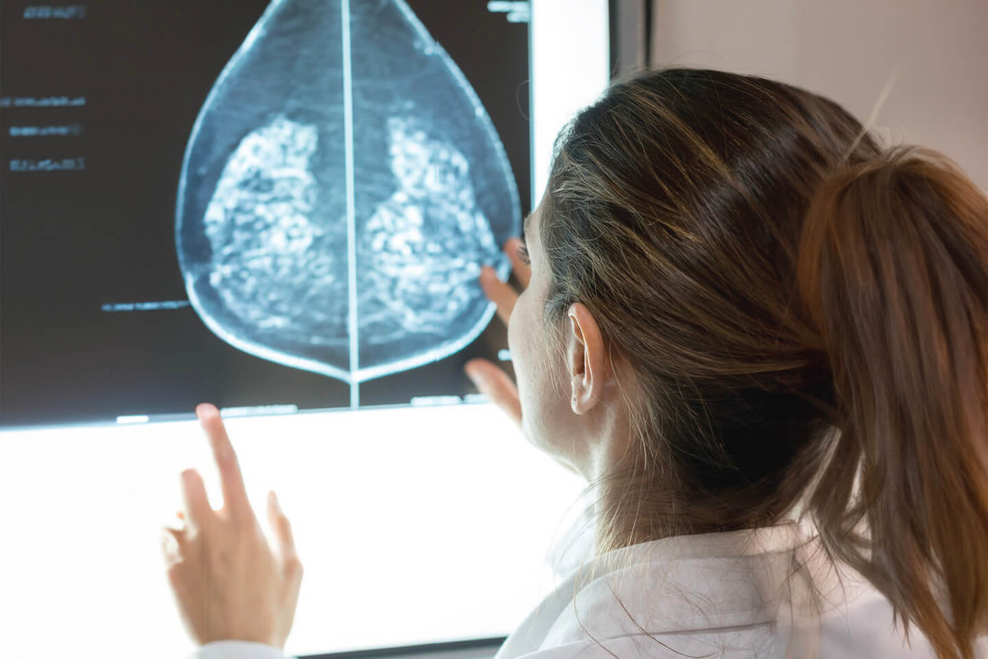 Machine Learning Drives Precision Cancer | UNC Gillings Carolina Public ...