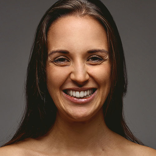 Fractional RF Skin Tightening Brisbane - Archon