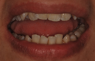 Dentist in City of London – Bow Lane Dental Group