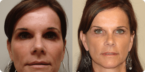 Center for Plastic Surgery | Dr. Sharf & Dr. Rigan