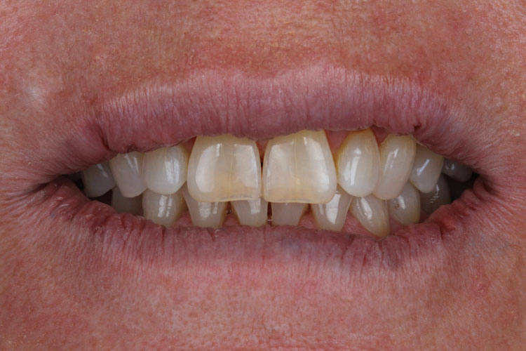 Smile Gallery | Livewell Dental Practice
