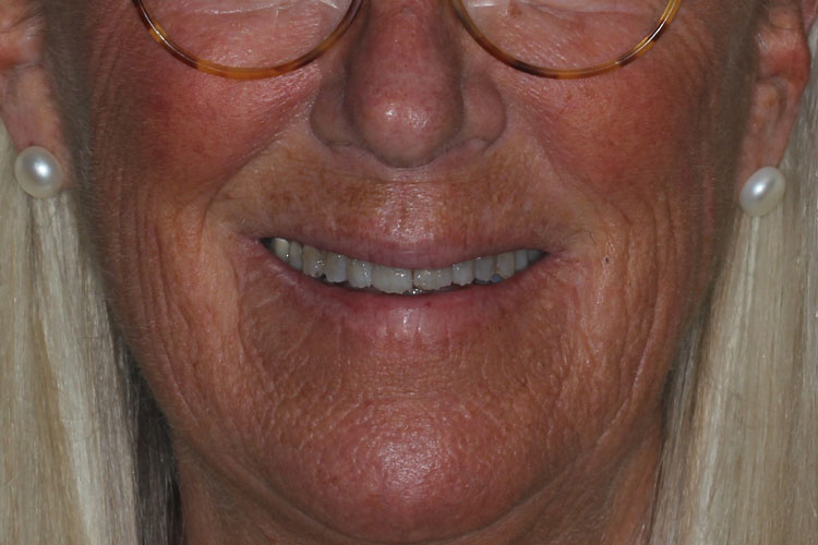 Smile Gallery | Livewell Dental Practice