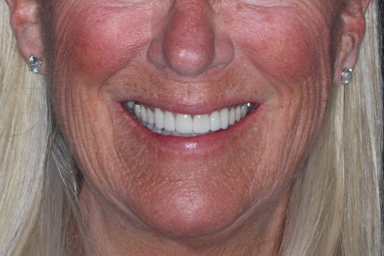 Smile Gallery | Livewell Dental Practice