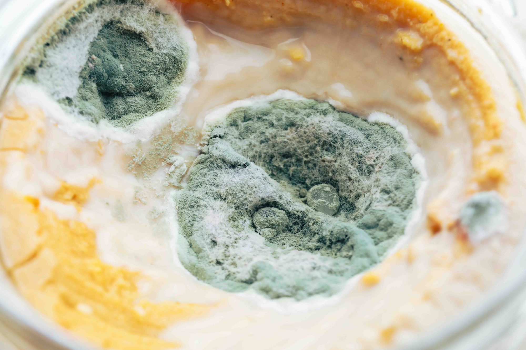 Hyperbaric Oxygen Therapy as a Treatment for Mold Exposure and Toxicity ...