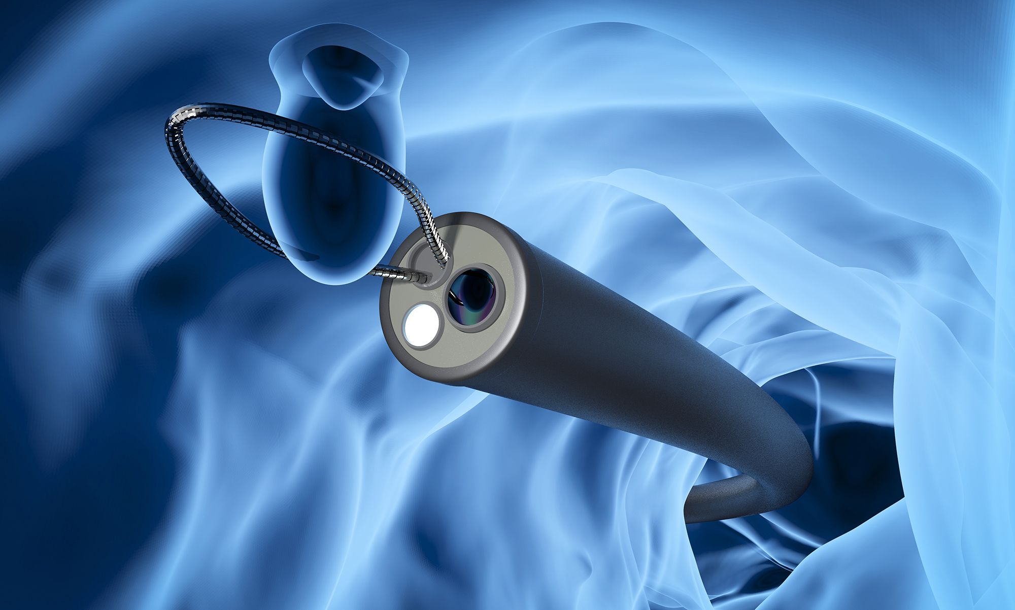 About Colorectal Cancer | CCRAN