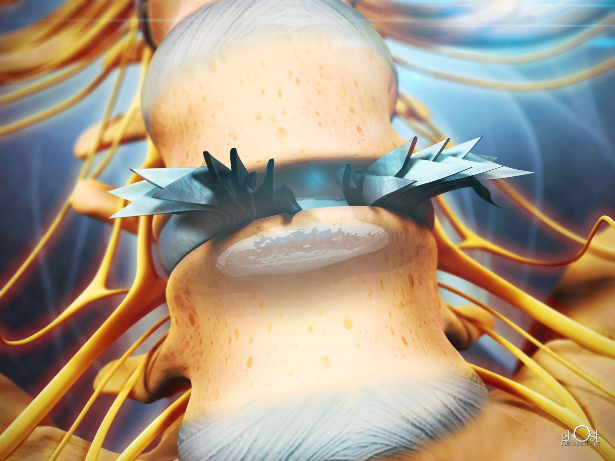 General Medicine Animations & Surgery Videos | Ghost Medical