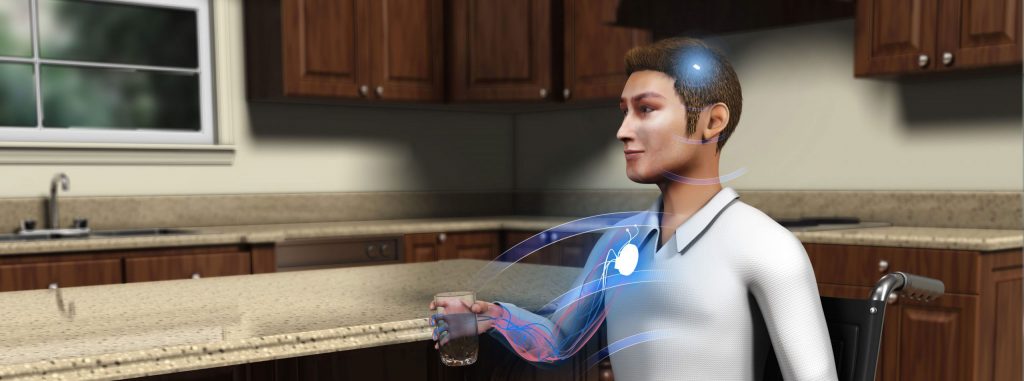 Synchron Stentrode 3D Character & Medical Device | Ghost Medical Images