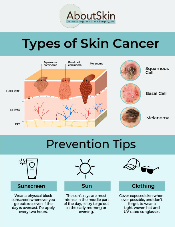 Treatments For Skin Cancer