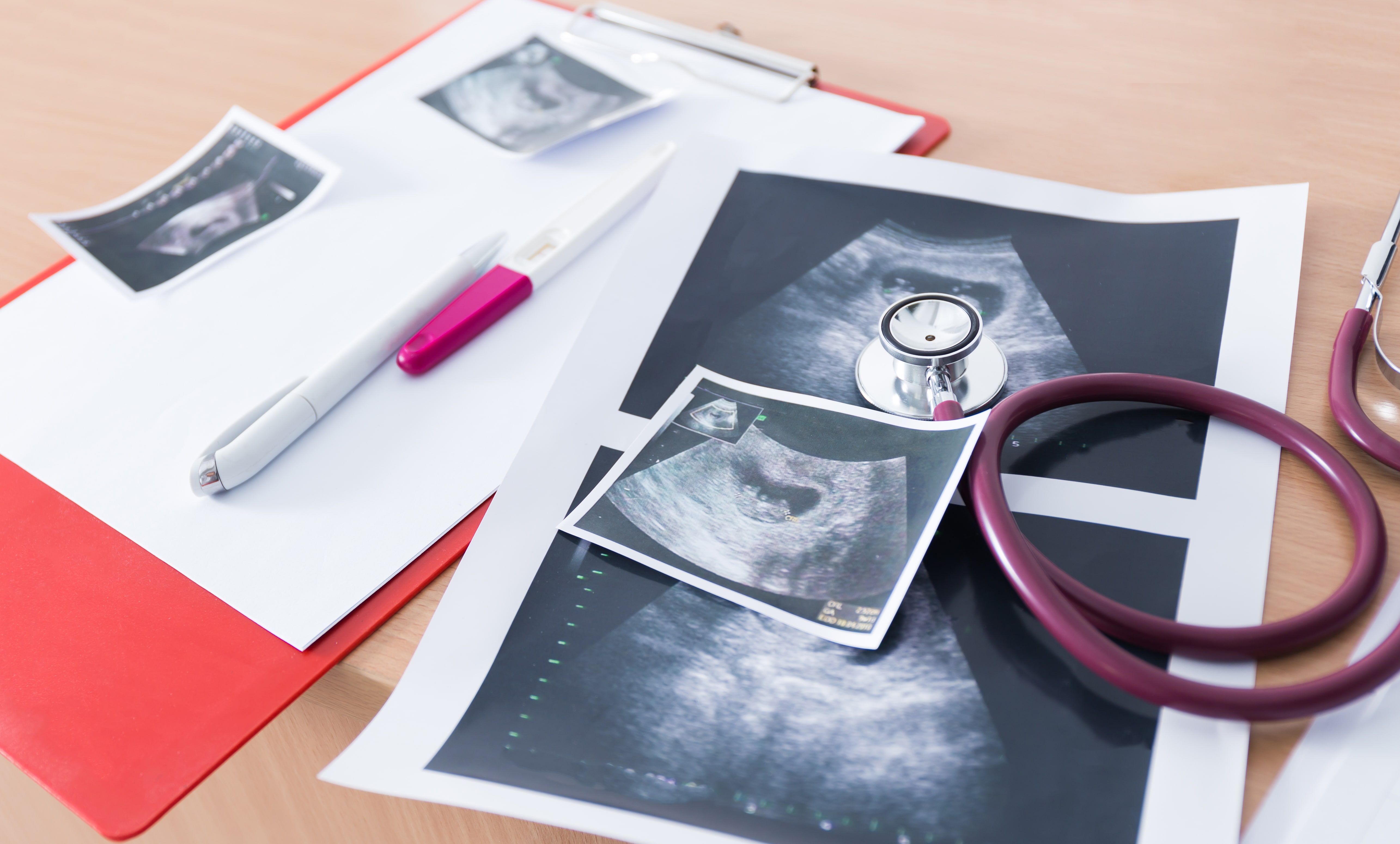Conception & Getting Pregnant | Fertilitywise