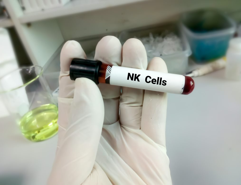 Natural Killer Cells - Testing & Treatment | Fertilitywise