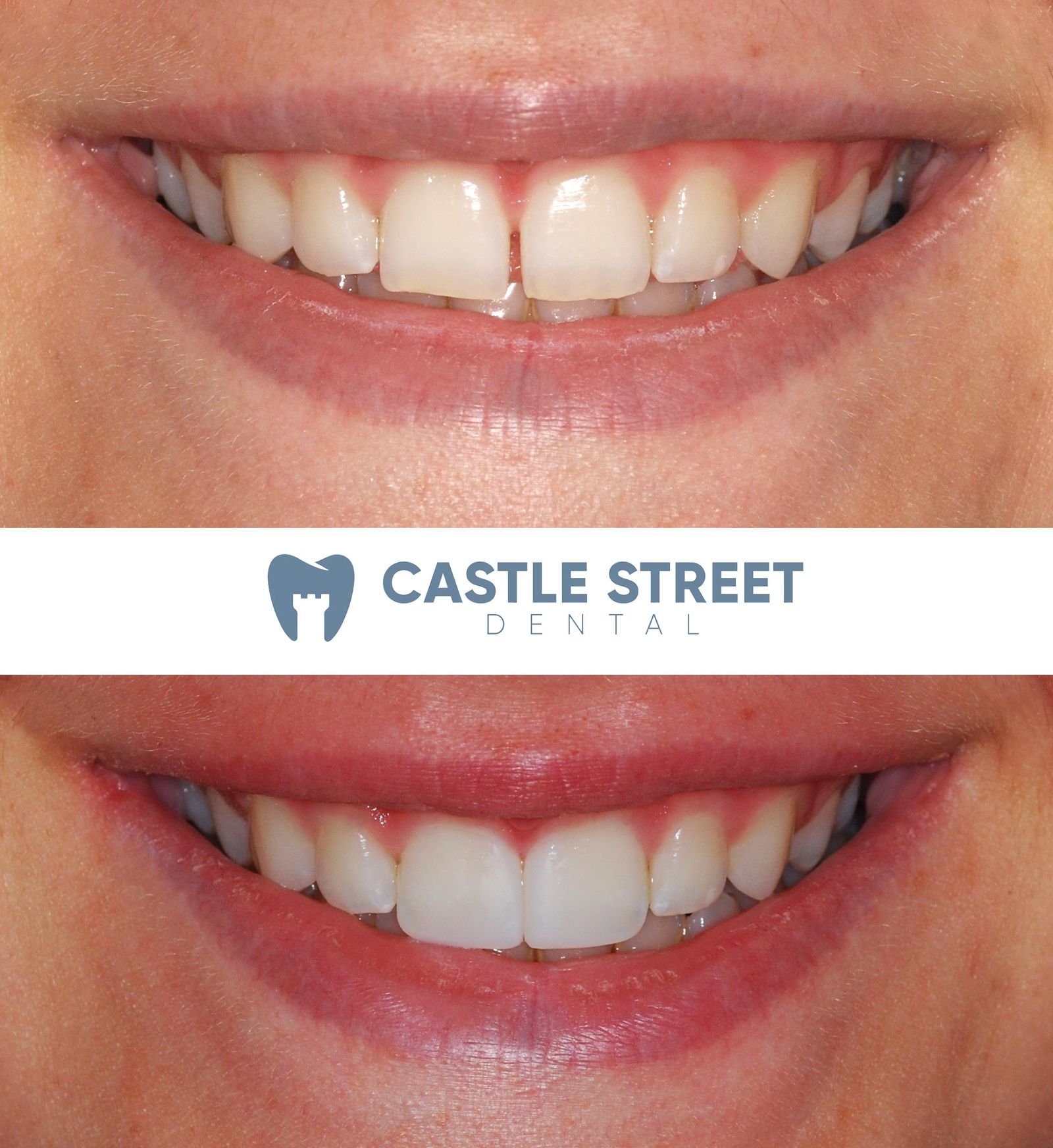 Castle Street Dental | Your Trusted Forfar Dentist | NHS and Private ...