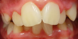 The best orthodontist in Nottingham | Invisalign teeth straightening ...