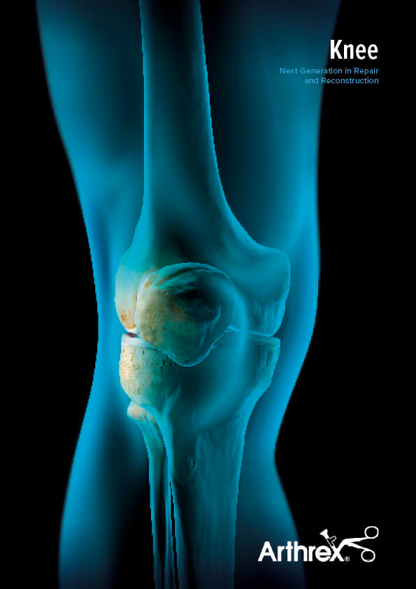 Your Specialist for Medical Technology | Arthrex UK
