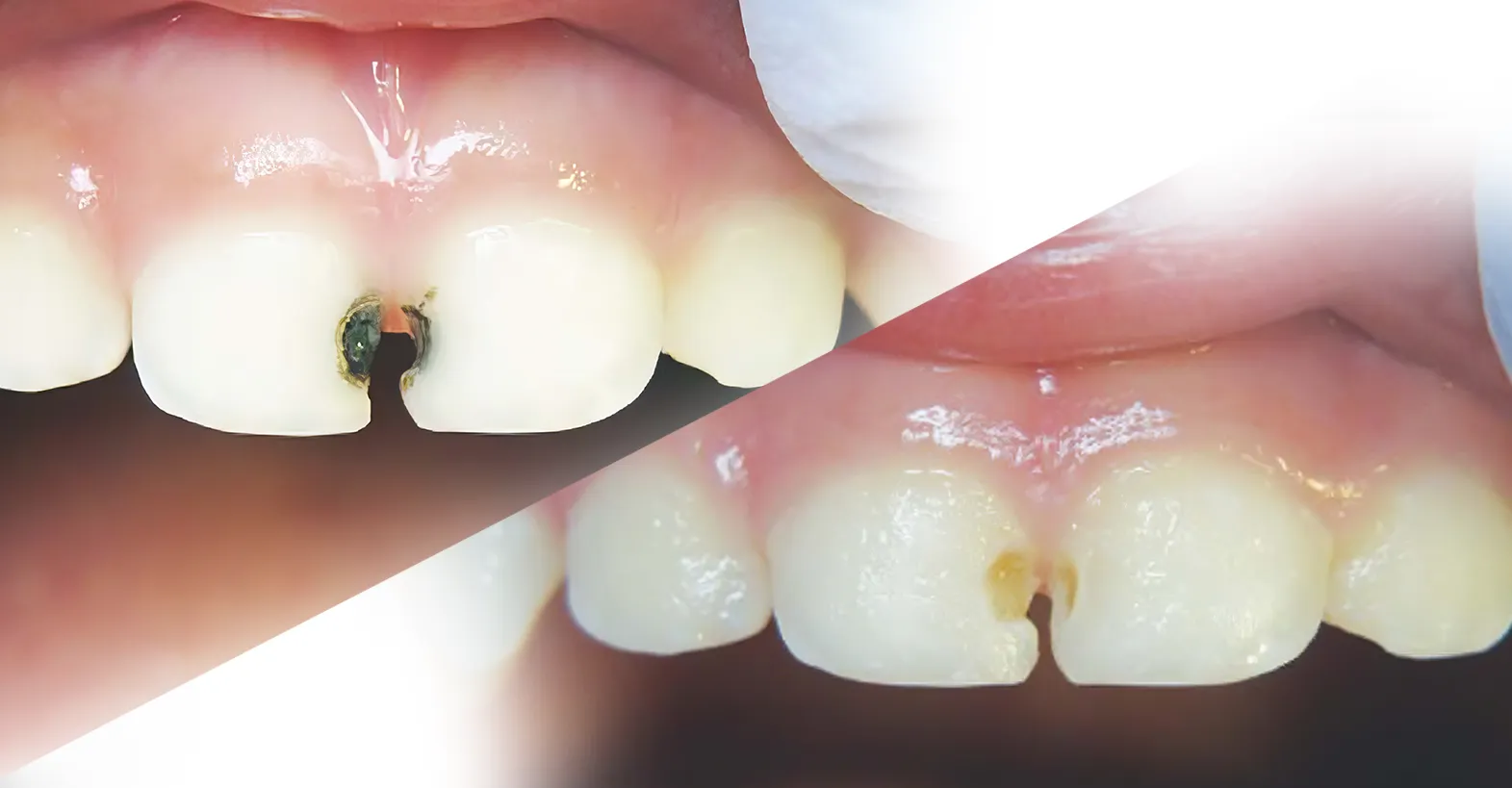 Dentist In Bellevue WA Art Of Pediatric Dentistry Dentist In Bellevue WA Art Of Pediatric Dentistry