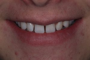 Award-winning general and cosmetic dentists in London | Fresh Dental ...