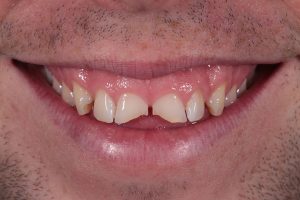 Award-winning general and cosmetic dentists in London | Fresh Dental ...