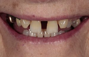 Award-winning general and cosmetic dentists in London | Fresh Dental ...