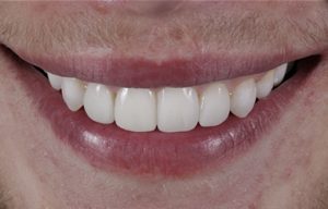 Award-winning general and cosmetic dentists in London | Fresh Dental ...