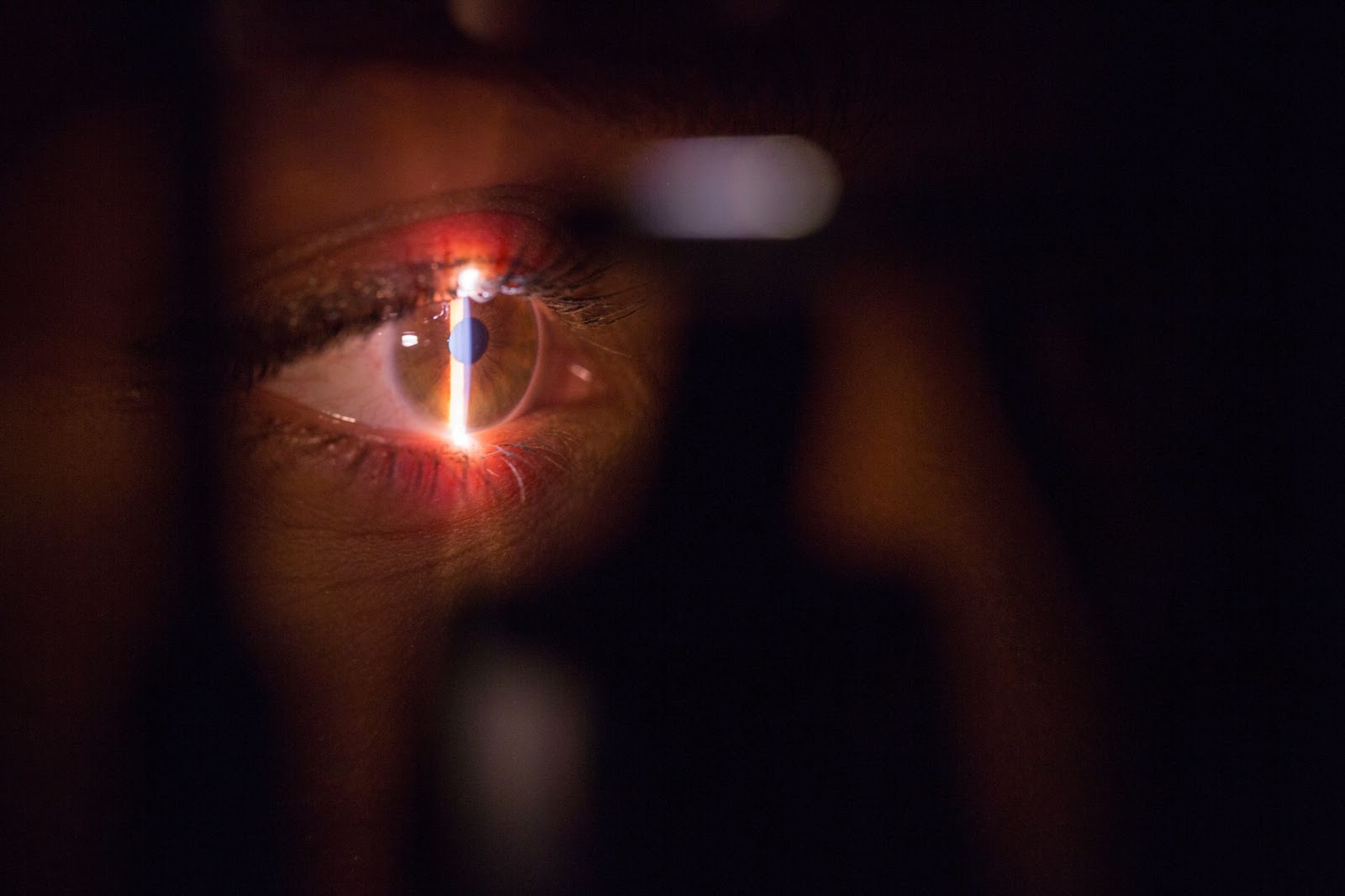Retinal Recognition: the Ultimate Biometric