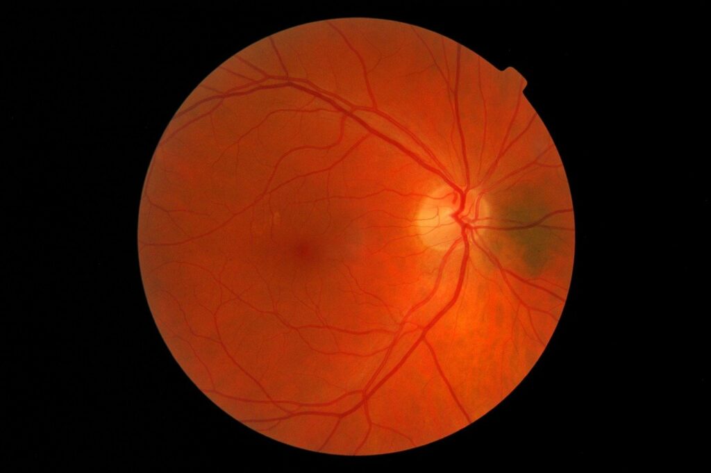 Retinal Recognition: the Ultimate Biometric