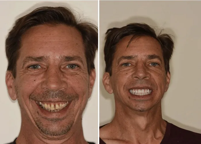 Dentist Near Me | Jolie Smiles | Smile Gallery