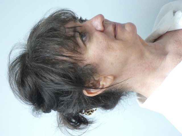 Facelift | Dr. George Parras M.D.