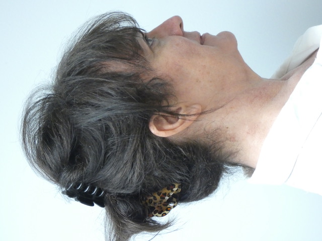 Facelift | Dr. George Parras M.D.