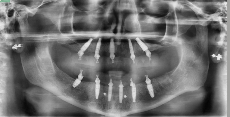 Colorado Surgical Institute