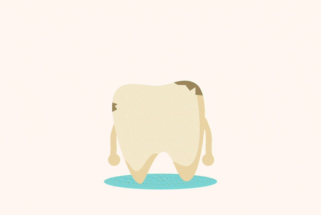 Crown Tooth Gif at Diane Carey blog