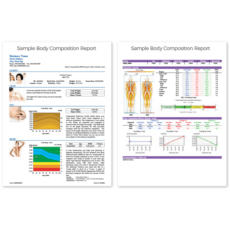 Body Composition DXA Scanning | Accurate Body Measurements