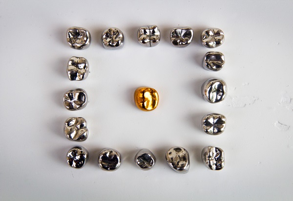 The FAQ's of Gold Dental Crowns - Sarko Dental Associates Scottsdale ...