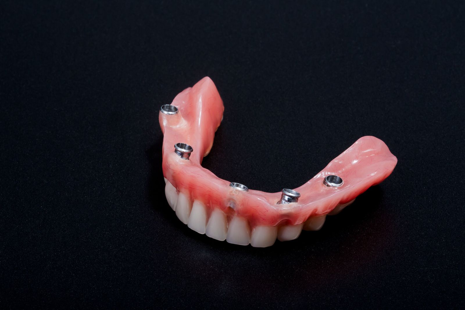 Hybrid Dentures | Jenkins Family Dentistry