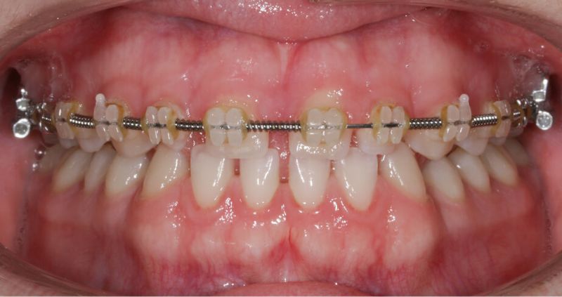 Bespoke Smiles Gallery