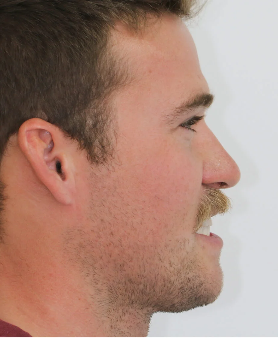 Bespoke Smiles Gallery