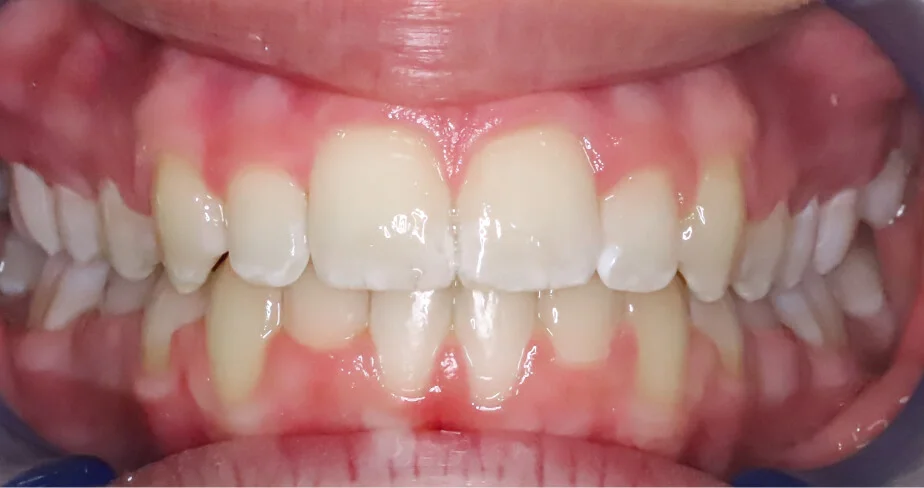 Bespoke Smiles Gallery