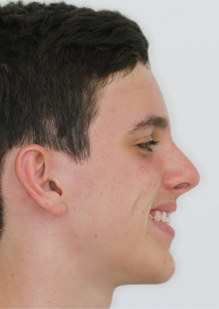 Bespoke Smiles Gallery