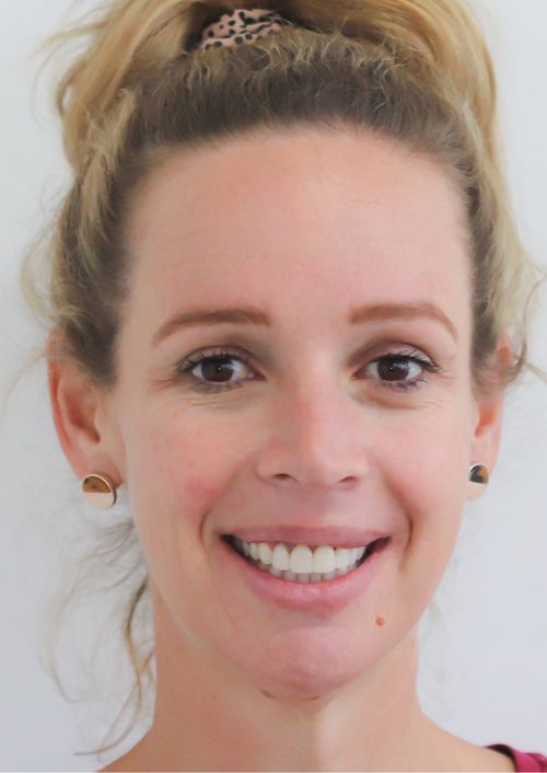 Bespoke Smiles Gallery