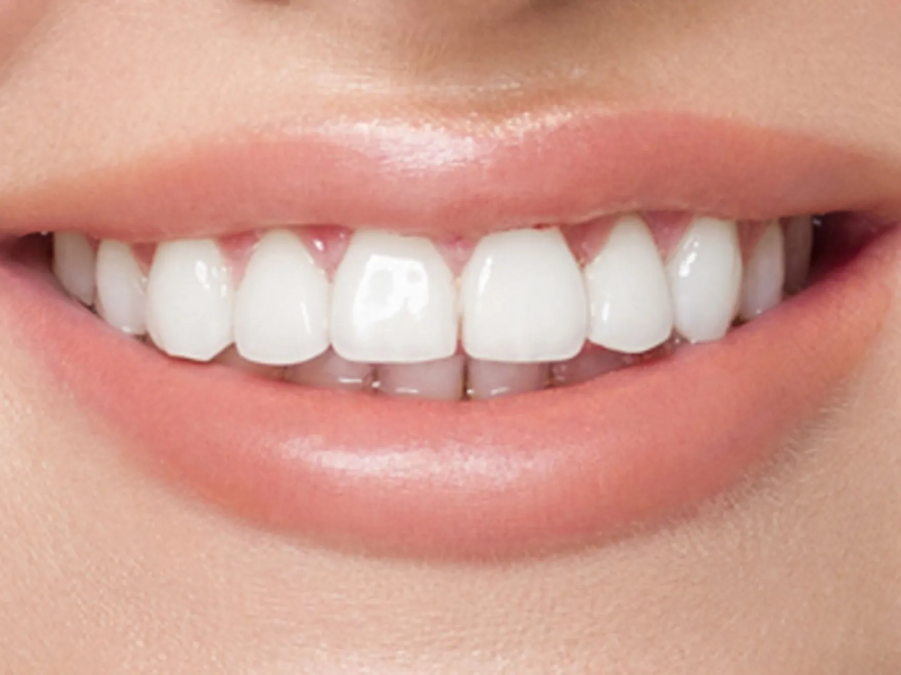 How to Repair Broken Teeth | Comfydent Smiles