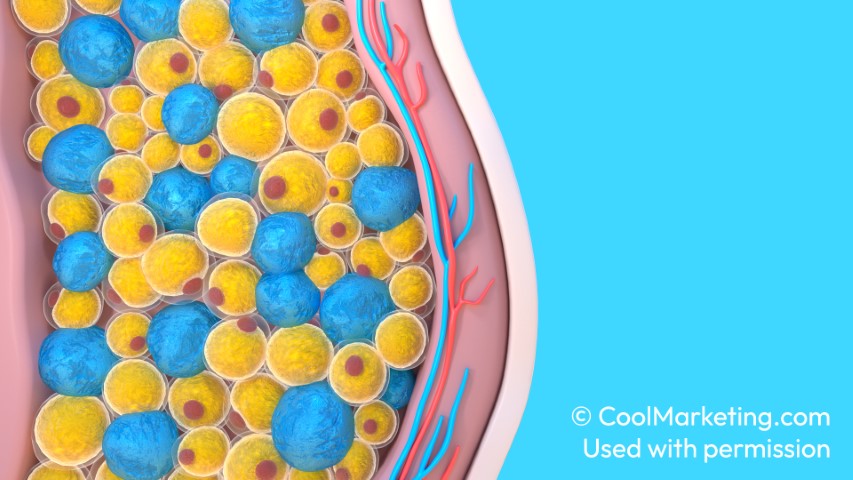 How CoolSculpting® Works