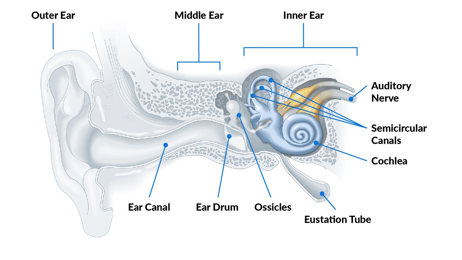 What is Tinnitus